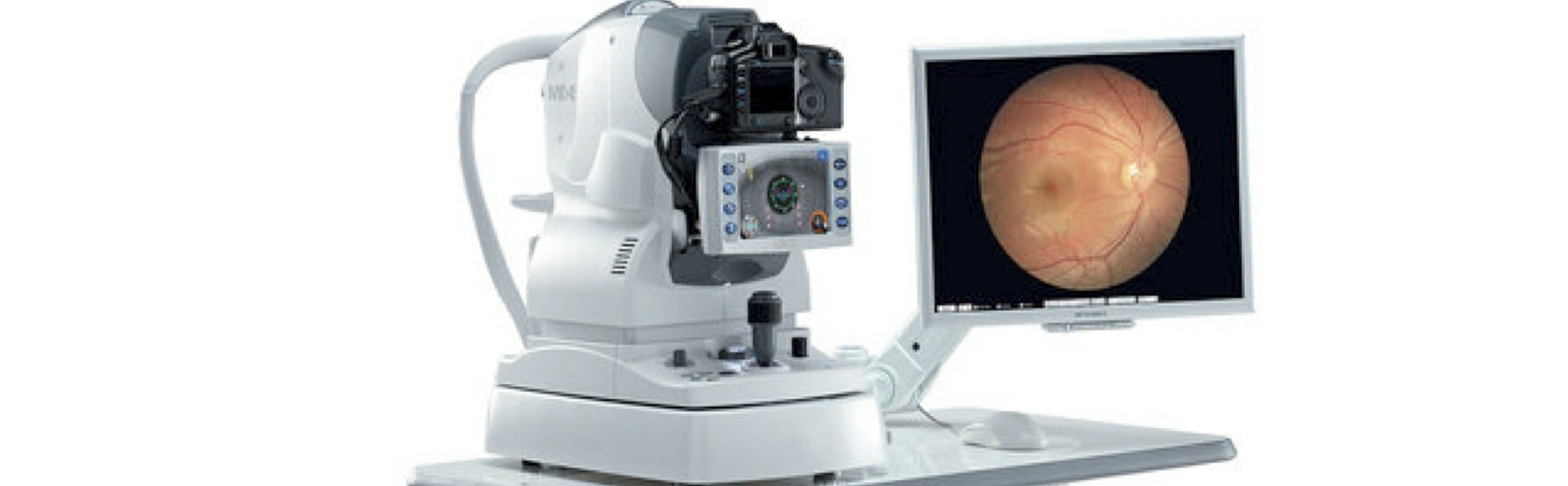 Retinal Imaging | Options Optometrists